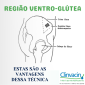 Região ventro-glúteo, essas são as vantagens dessa técnica.